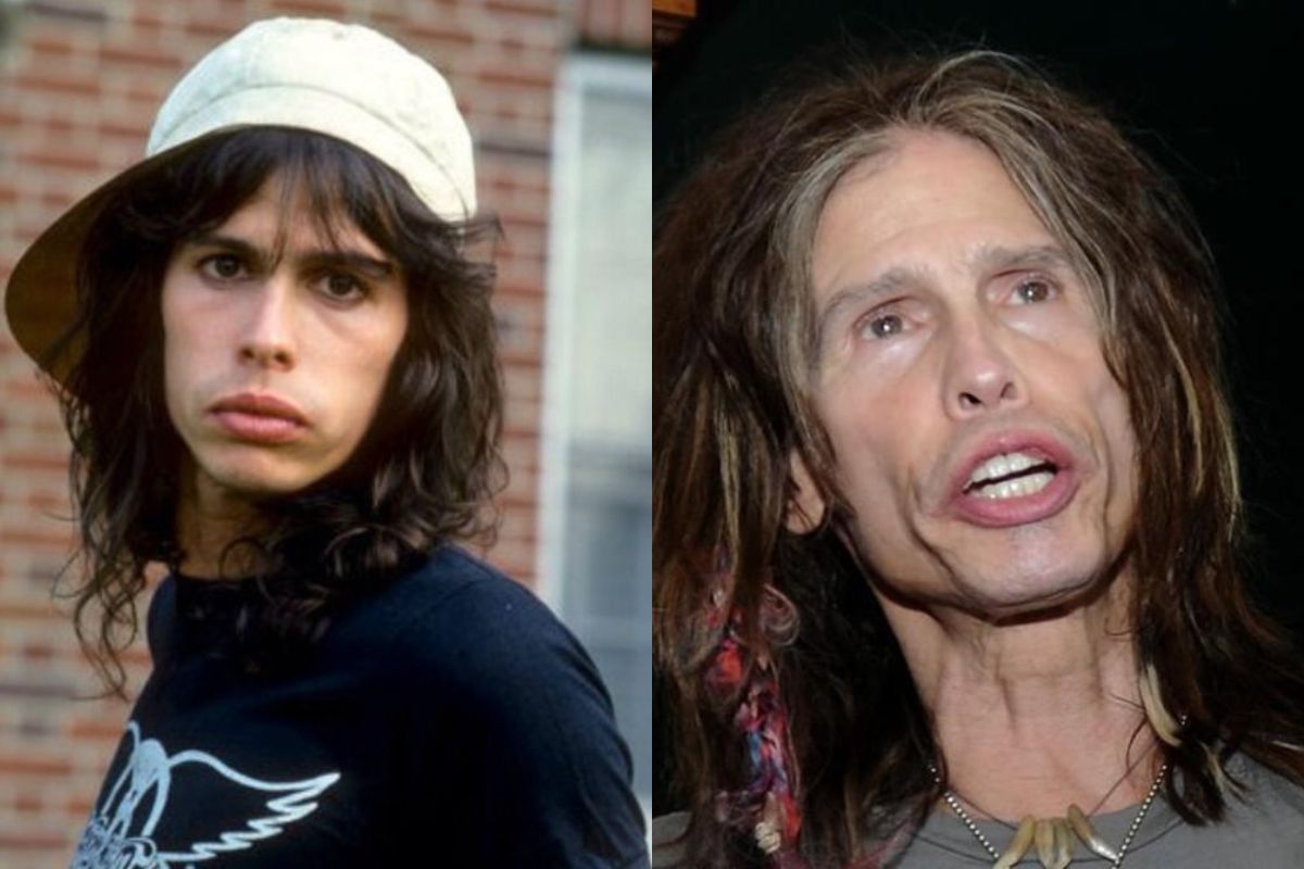 La cirugía estética marcó a siete íconos del cine y la música - El Comercio